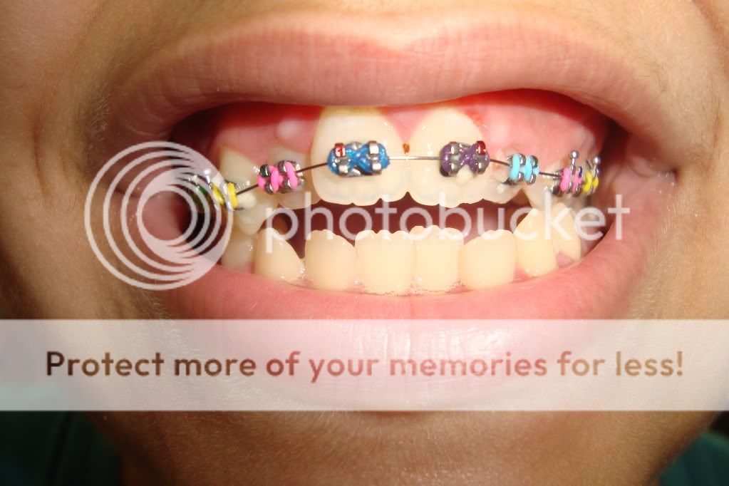 Healthy Gums Start Here With This Excellent Advice | tonyaorta